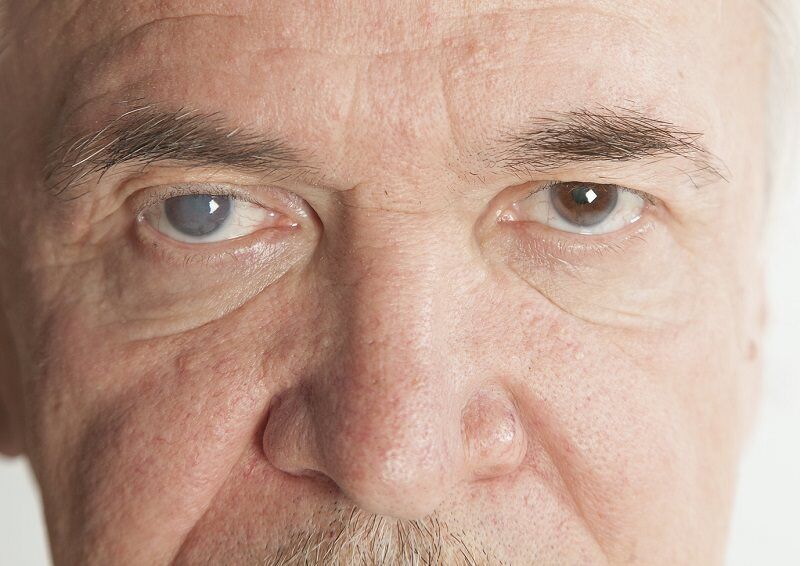 Degeneración Macular Una Guía Completa Sobre Esta Afección Ocular
